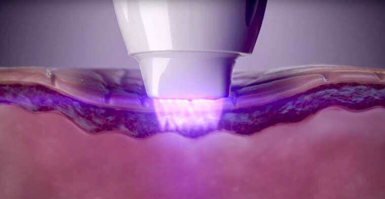 SmoothGlo - Advanced Skincare