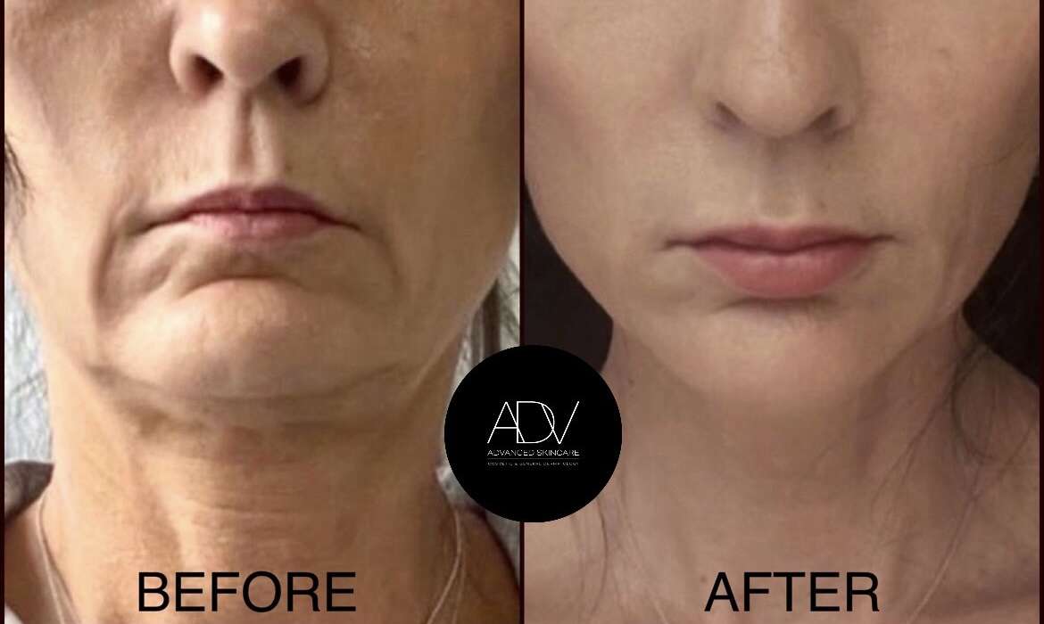 SmoothGLO & Threads - Advanced Skincare