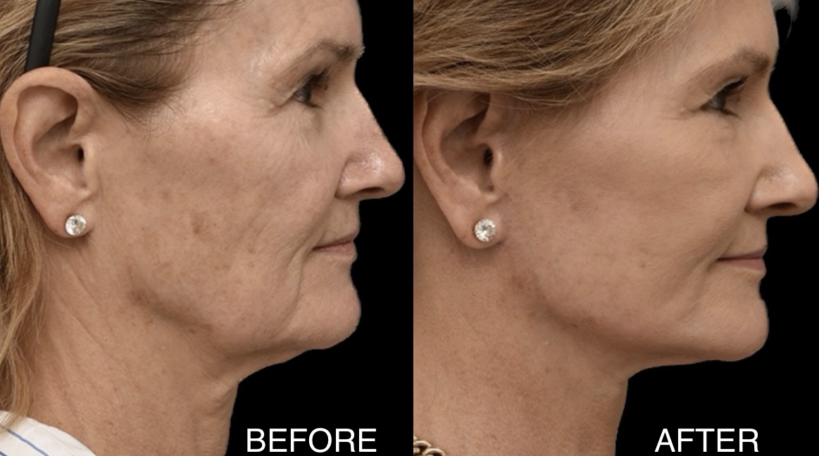 SmoothGLO & Threads - Advanced Skincare